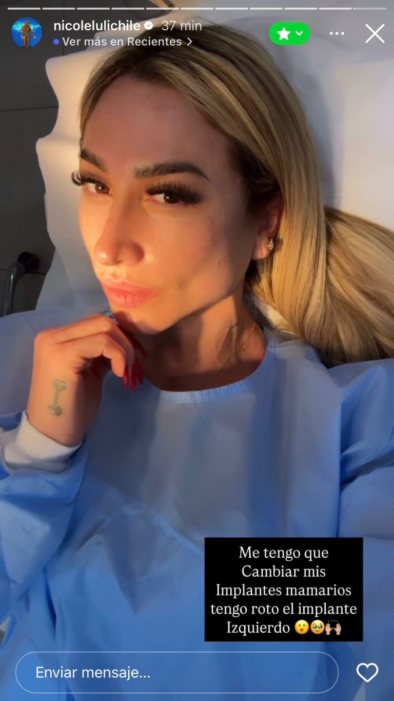 Nicole Moreno revela delicado problema de salud por el que será ...