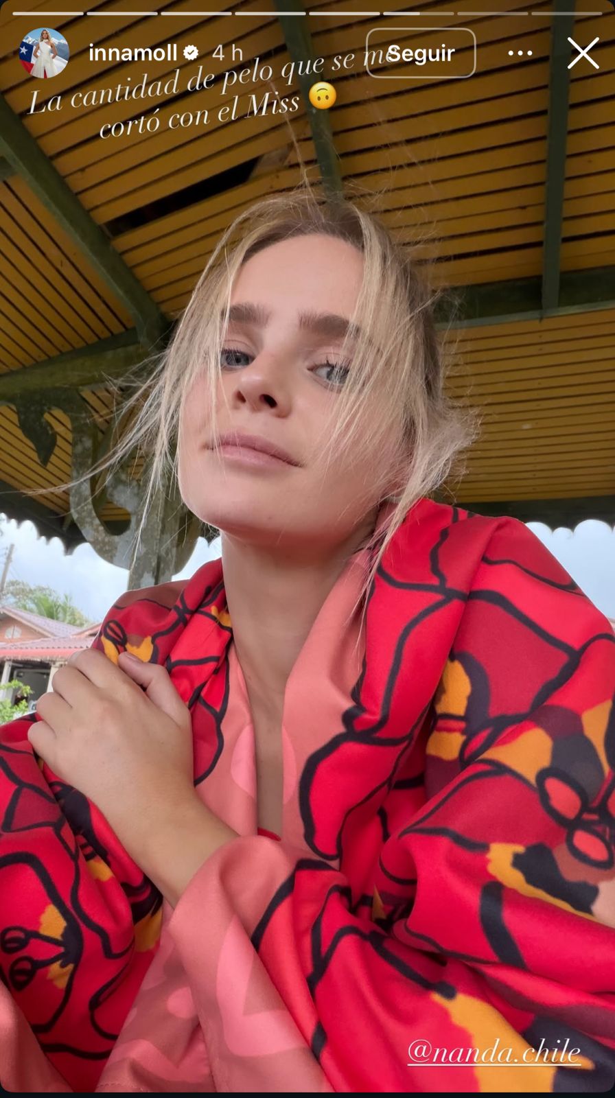 Impacto: Inna Moll revela el daño físico que arrastra luego de Miss ...